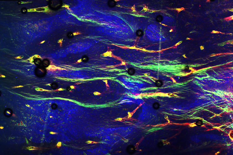 LMA Micrograph Competition – Australian Microscopy and Microanalysis ...