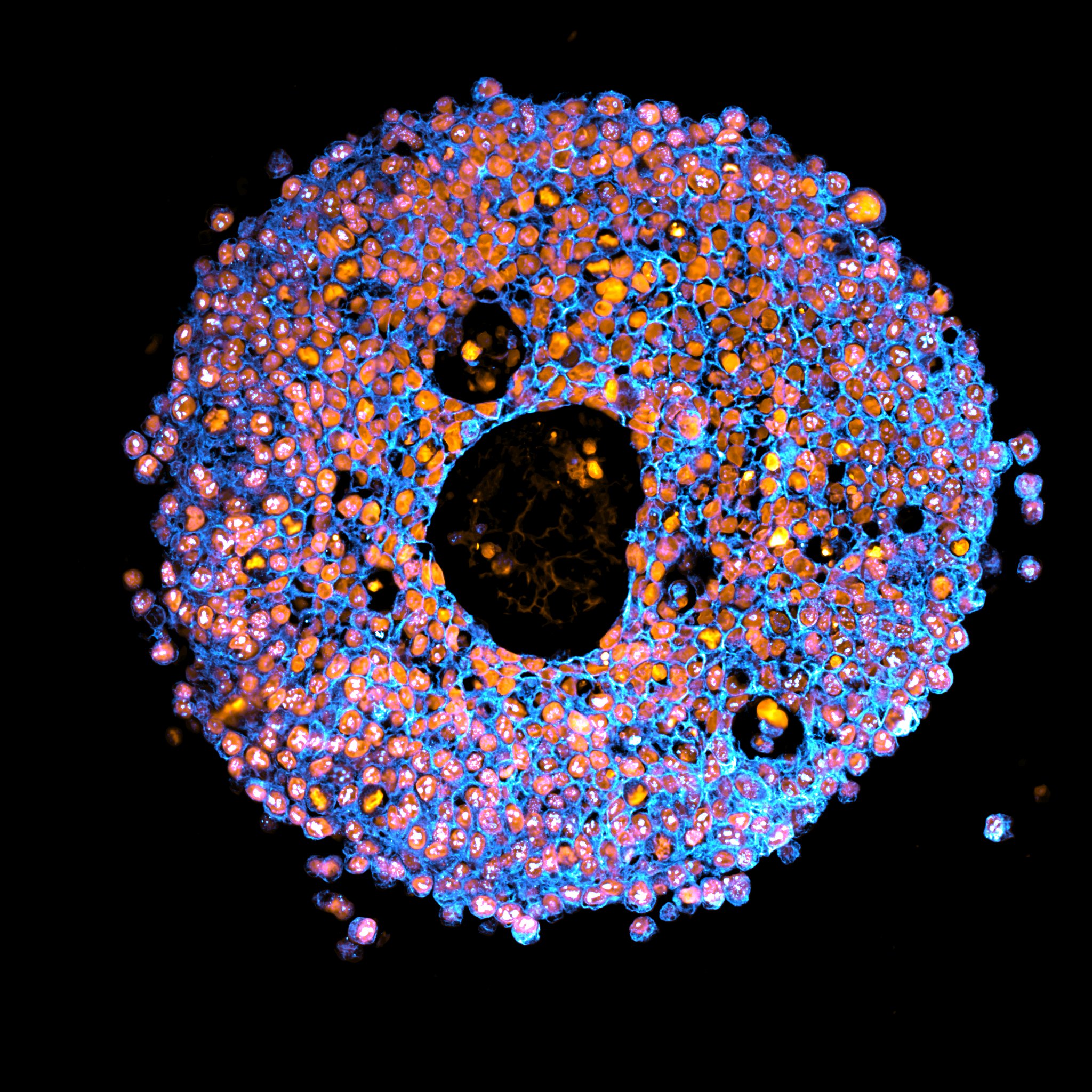 LMA and VIA 2023 Image Competition Winners – Life Science Category ...